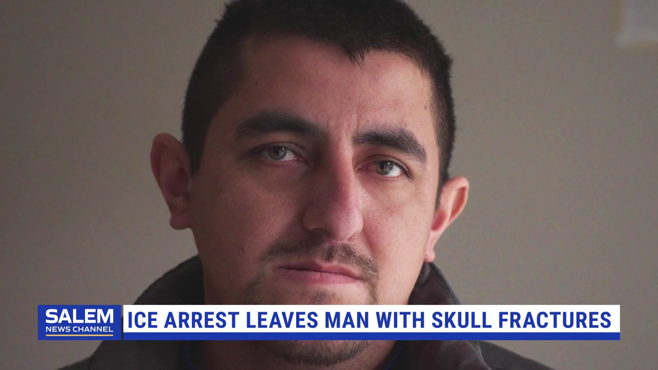 FBI, St. Paul Police Investigate ICE Arrest That Left Man With Skull ...